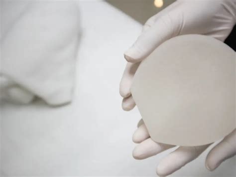 What Is An Encapsulated Breast Implant Aftercare Tips And Processes