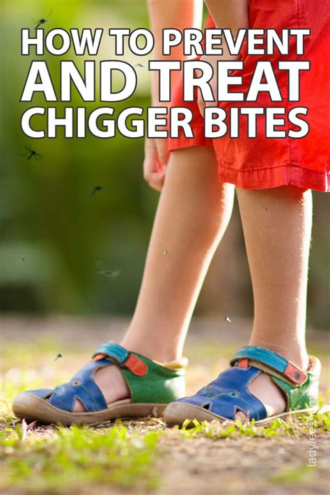 How To Prevent And Treat Chigger Bites Artofit