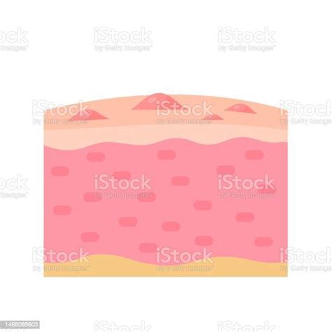 Human Skin Layer Caring For Protecting The Skin From The Sun With A