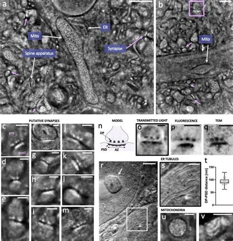 让细胞膨胀8000倍！耶鲁团队革命性发明，肉眼也能看清细胞 知乎