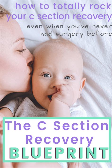 C Section Recovery Blueprint C Section Recovery Timeline C Section Recovery C Section