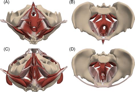 Icd 10 Code For High Tone Pelvic Floor Dysfunction Male