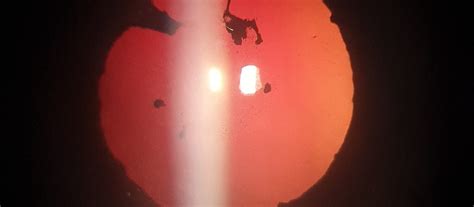 Uveitis Illuminating The Roots Repercussions And Prospects For