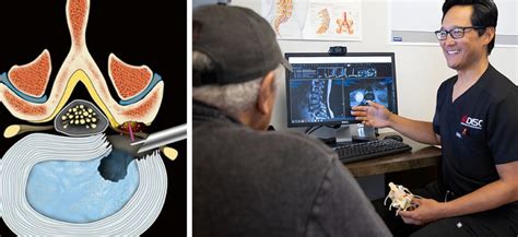 The Role Of Lasers In Minimally Invasive Spine Surgery