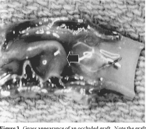 Figure 3 From A Comparison Of Distal Endoluminal Graft Fixation Methods Healing Characteristics