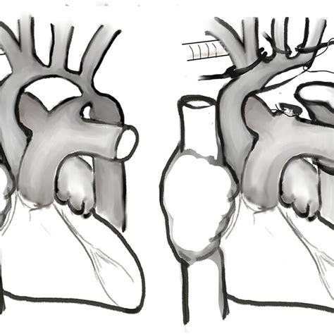 Tissue Saturation In Different Organs In Selective Cerebral Perfusion Download Scientific