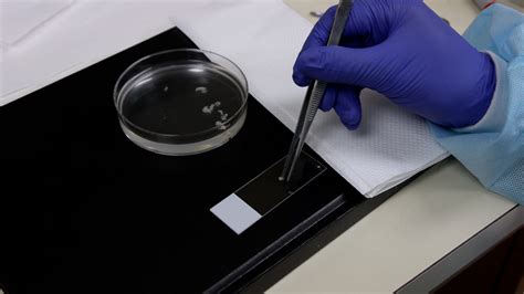 Video 3d Imaging Of The Liver Extracellular Matrix In A Mouse Model Of
