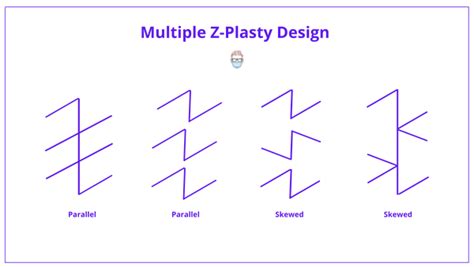 Z Plasty Designs Indications Variations And Complications