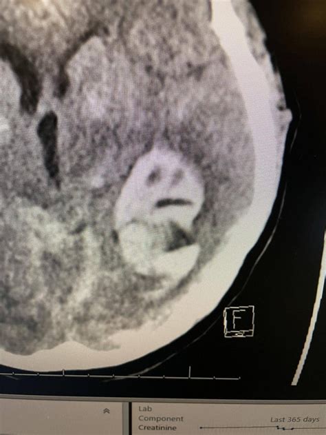 What Kind Of Positioning Had To Happen To Get This Exam Done R Radiology