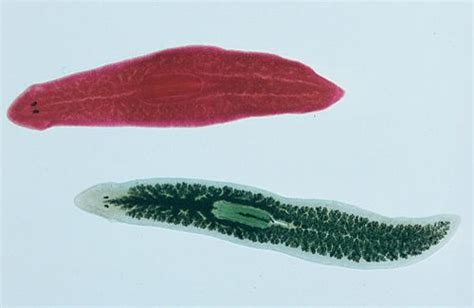 Planaria Under Microscope Labeled