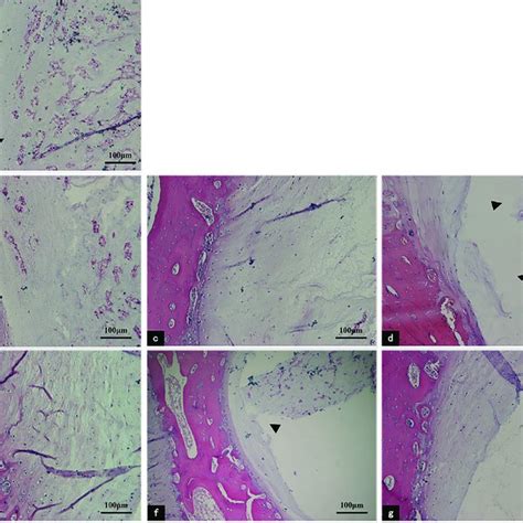 Hande Staining Of The Sagittal Sections Of Ivd In The Control And