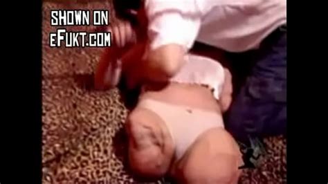 Triple Amputee Xxx Mobile Porno Videos And Movies Iporntv Net