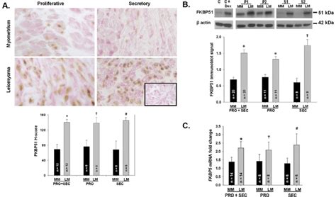 Greater In Situ Fkbp51 Protein And Mrna Levels In Leiomyoma Vs Paired
