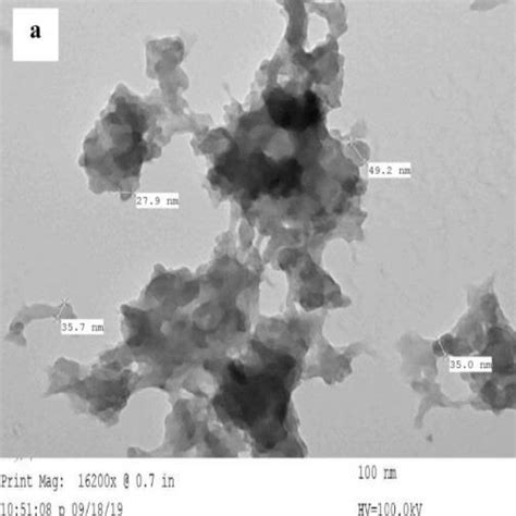 Tem Of A Dpe Iii At Magnification 30000× B Dpe Iv At Download Scientific Diagram