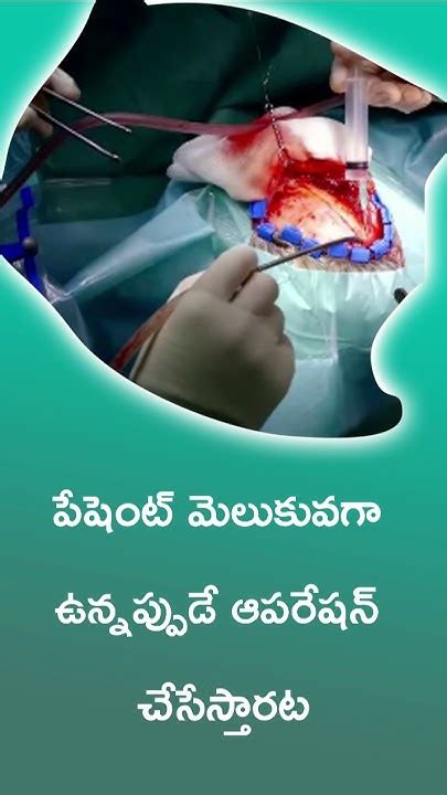 పేషెంట్ మెలకువగా ఉన్నప్పుడే ఆపరేషన్ చేస్తారట Facts Telugufacts