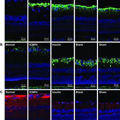 He Staining And Tem Observation Of The Retinal Microstructure And