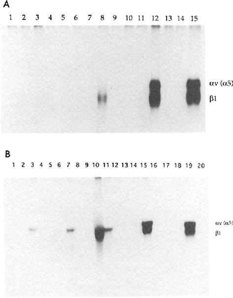 Figure 1 From The Alpha V Beta 1 Integrin Functions As A Fibronectin