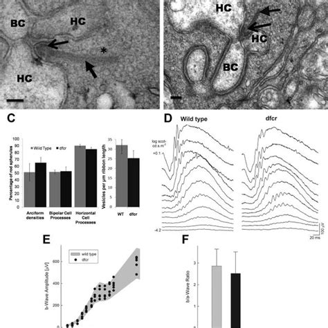 immunoelectron micrographs of the inner outer segment junction of rod