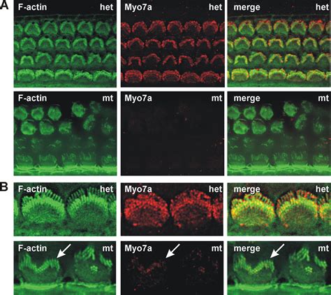 A Novel Allele Of Myosin Viia Reveals A Critical Function For The C