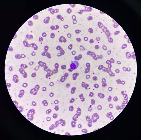 Atypical Lympho Cyte In Red Blood Cell Background Stock Image Image