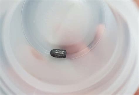 Người Phụ Nữ Bị đạn Bắn Trúng đầu Khi đang Làm Vườn Báo Công An Nhân