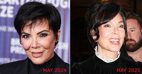 Kylie Jenners Salmon Sperm And Surgery Addiction