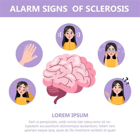 Diagrama Da Esclerose Múltipla Ilustração do Vetor Ilustração de motor médico