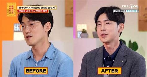 소개팅 50번 퇴짜男 양악·쌍꺼풀 수술로 환골탈태