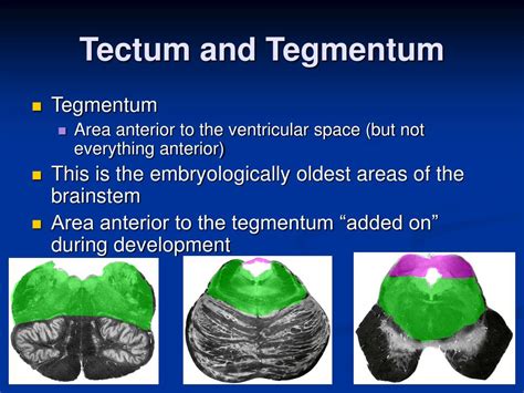 Ppt Brain Stem I Powerpoint Presentation Free Download Id 628947