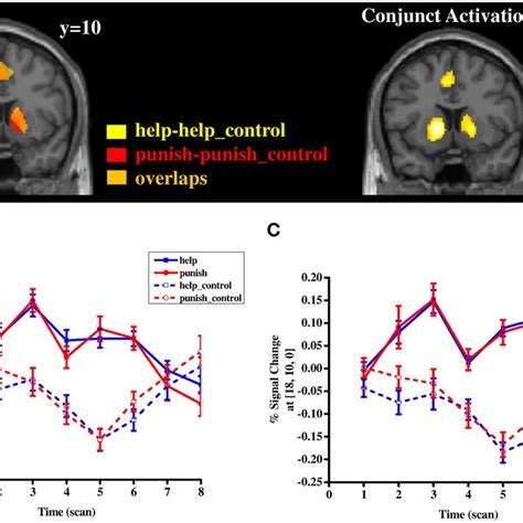 Regions Showing Increased Functional Connectivity With Bilateral