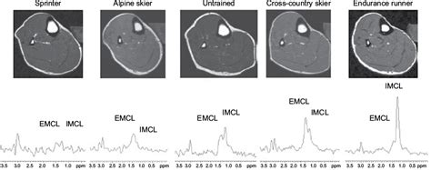 Intramyocellular Lipids Of Muscle Type In Athletes Of Different Sport
