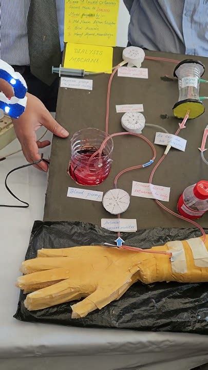 Science Model Of Dialysis Techniques Bpharmacy Student Prepared