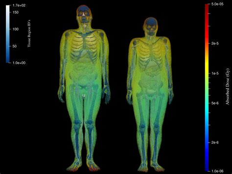 Un Nuevo Método Permite Estimar La Radiación Que Recibe El Cuerpo
