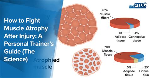 How To Fight Muscle Atrophy After Injury A Personal Trainers Guide