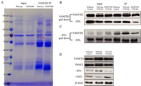 Fa Pathway Activation Facilitated By Dtl Under Uv Exposure Coomassie