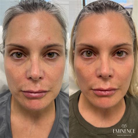 Pdo Thread Results Princeton Montgomery Nj Eminence