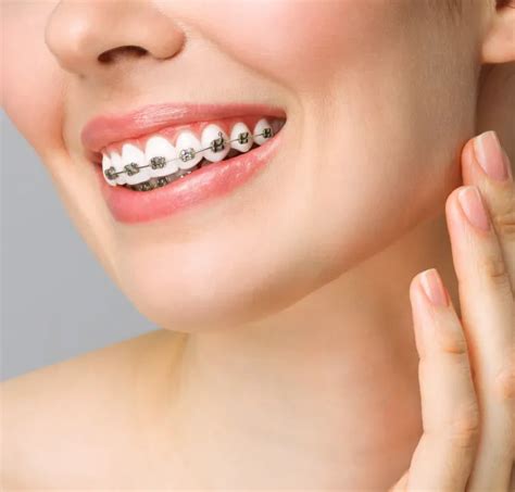 Fix Gap Between Teeth Teeth Gap Filling Treatment In Ahmedabad