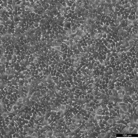 Hek293t17 Cells