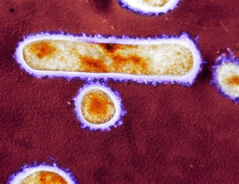 Lactobacillus Casei Plated