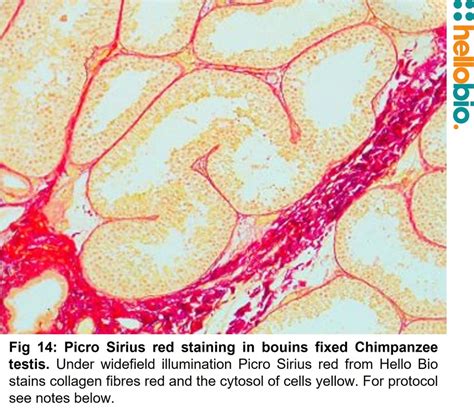 Picro Sirius Red Stain Kit Collagen Connective Tissue Stain Hello Bio