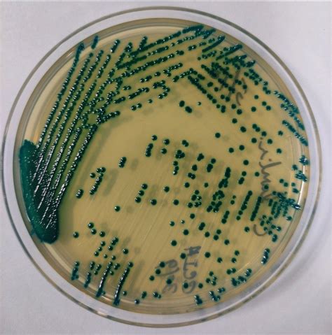 Anooj O On Linkedin Cronobacter Sakazakii On Chromogenic Cronobacter Isolation Agar