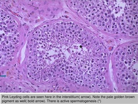 Ppt Testicular Pathology Powerpoint Presentation Free Download Id