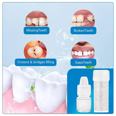 Tooth Repair Kit Diy Moldable False Teeth Repair Glue For Broken Or