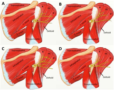 Axillary Nerve Deltoid