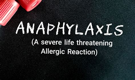 Epinephrine Nasal Spray Now Available To Treat Type 1 Allergic
