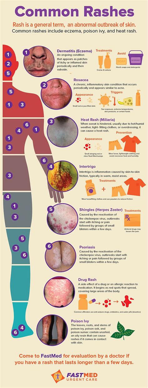 Common Rashes Infographic Nursing School Nurse Nursing Tips