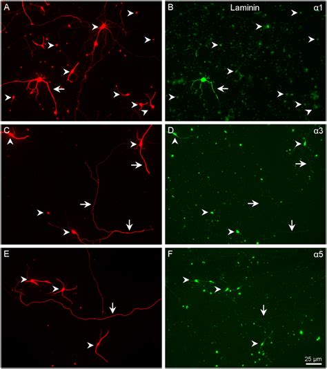 Distribution Of α Integrins In Rgcs Growing In Laminin Paired Images Download Scientific
