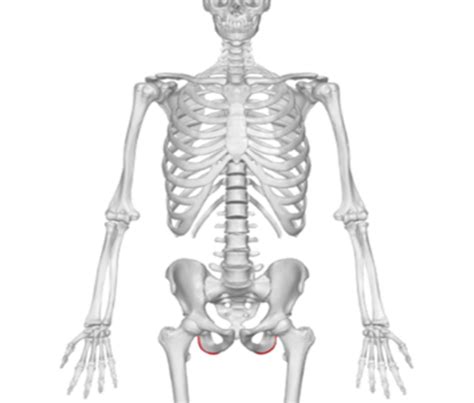 Ischial Bursitis Dr Mahmood Ahmad