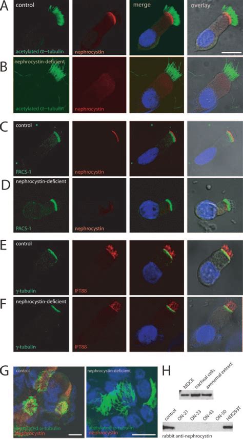 Nephrocystin Deficient Respiratory Epithelial Cells Form Normal Cilia