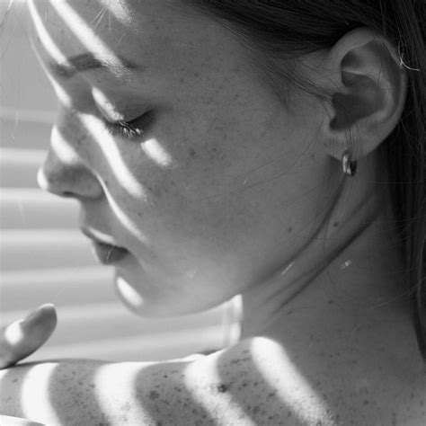 The Truth About Stubborn Brown Spots Revay Aesthetics